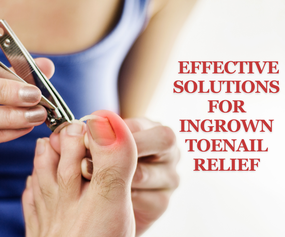 Effective Solutions for Ingrown Toenail Relief | Jersey Family Foot and ...